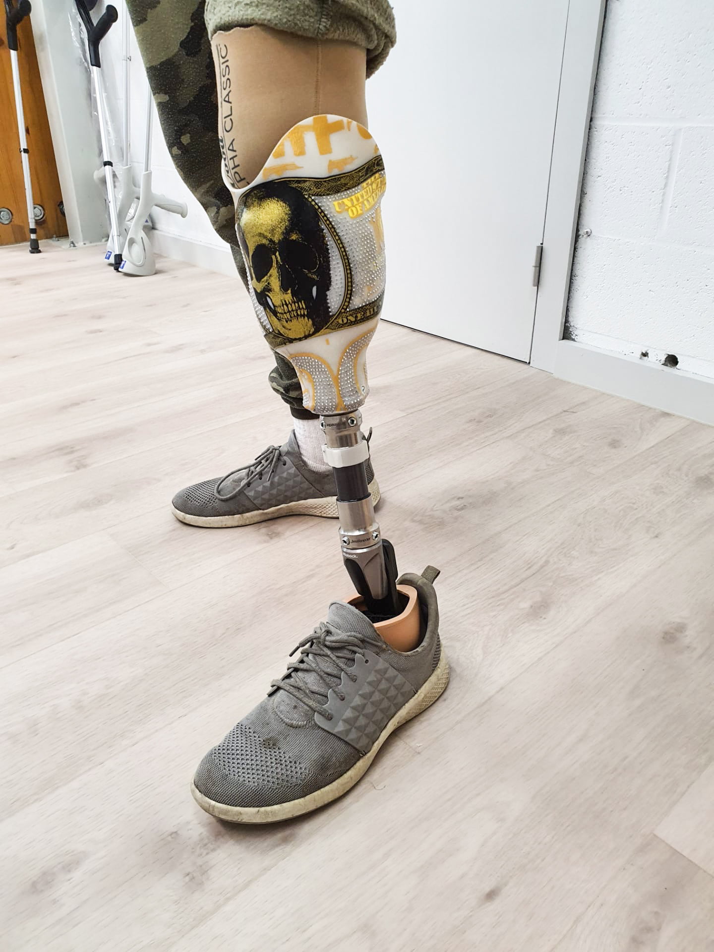Prothèse sur-mesure Mons et Charleroi– Orthopédie Protechnik